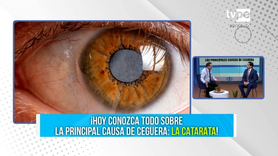 Doctor TB: Conoce las causas más comunes de ceguera en el Perú