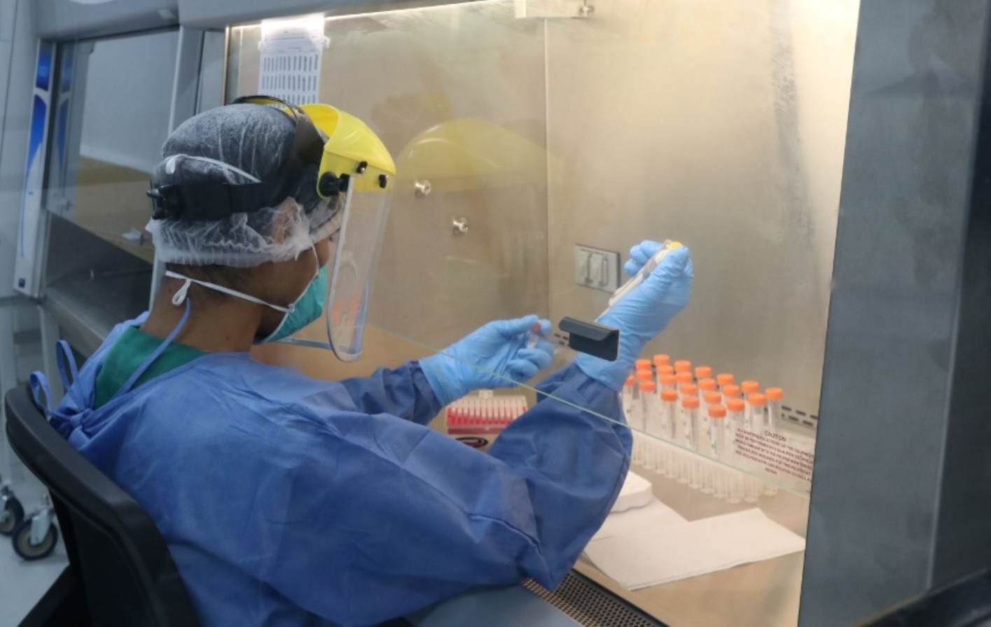 COVID-19: Perú cuenta con 12 laboratorios para pruebas moleculares | TVPerú